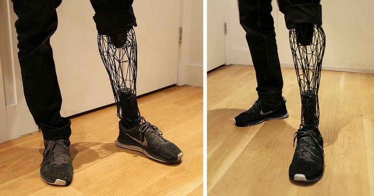 3D-scanned and printed Exo prosthetic leg made from titanium designed ...