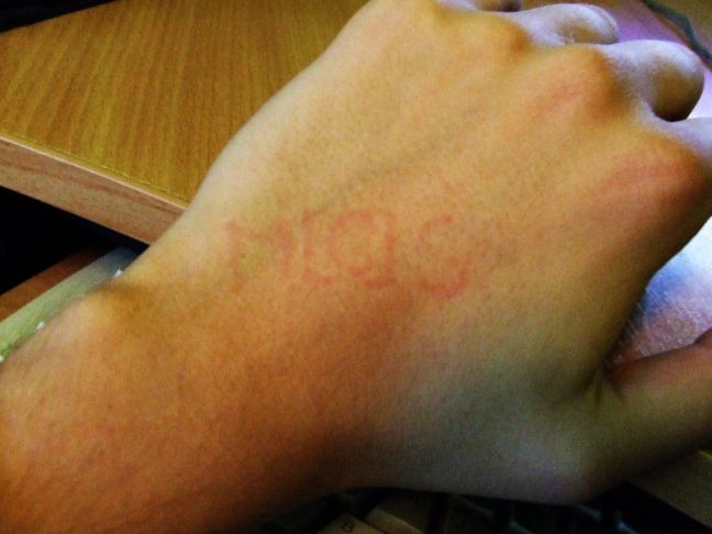 Dermatographic urticaria - MyConfinedSpace